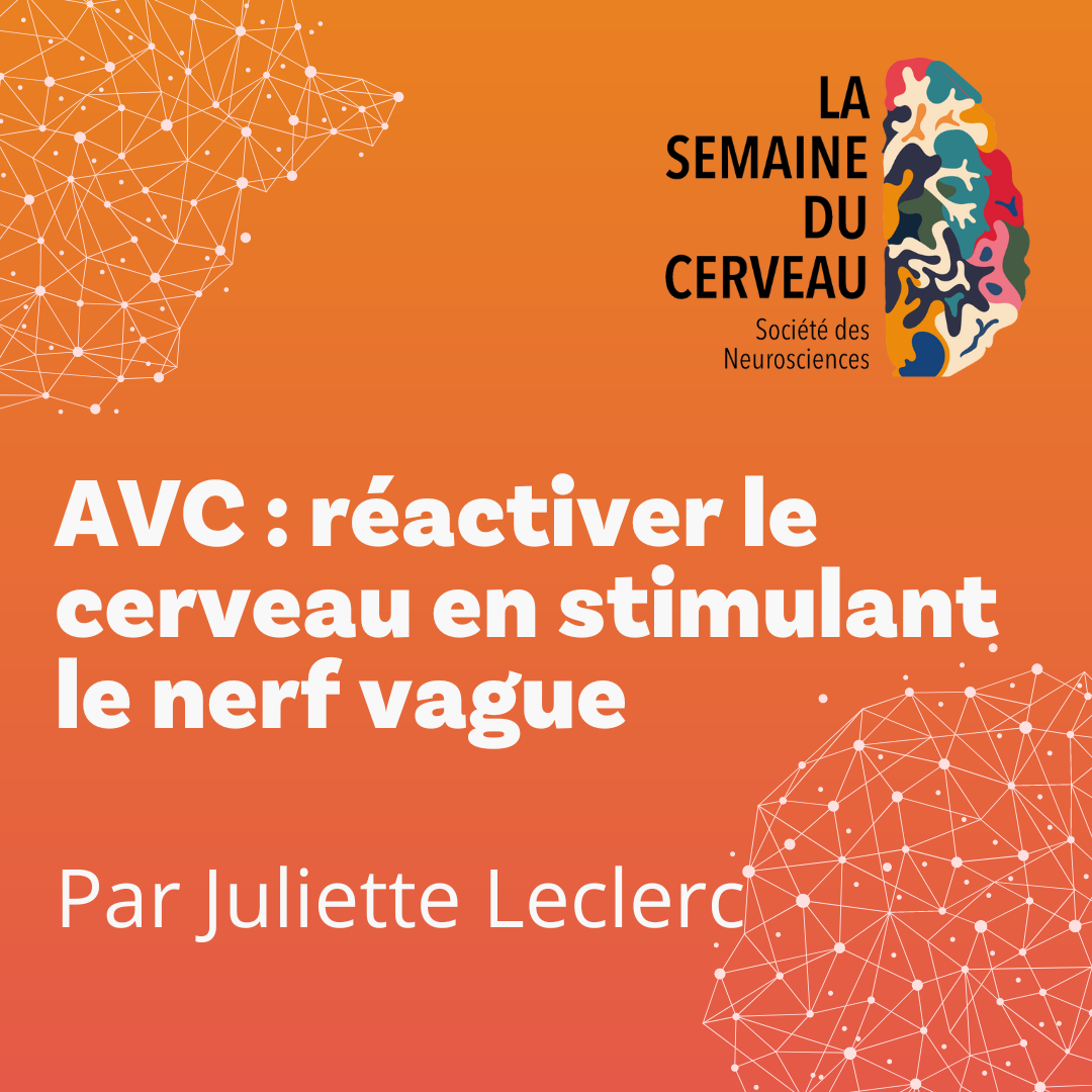 Juliette Leclerc - AVC : Réactiver le cerveau en stimulant le nerf ...